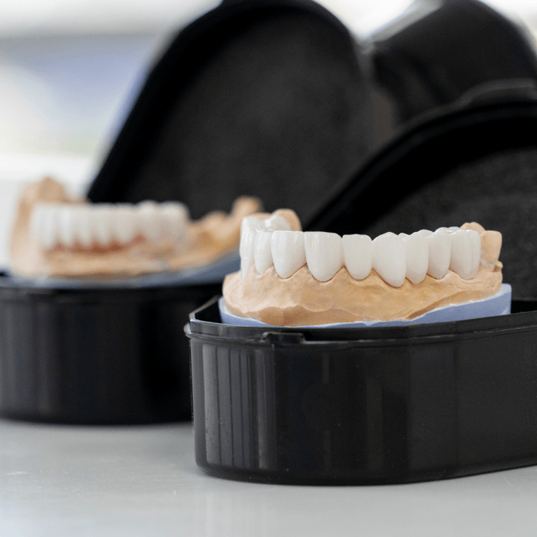 The Road to a Perfect Smile: A Guide to Veneers - Hopkins Dental Health The Road to a Perfect Smile: A Guide to Veneers - Hopkins Dental Health